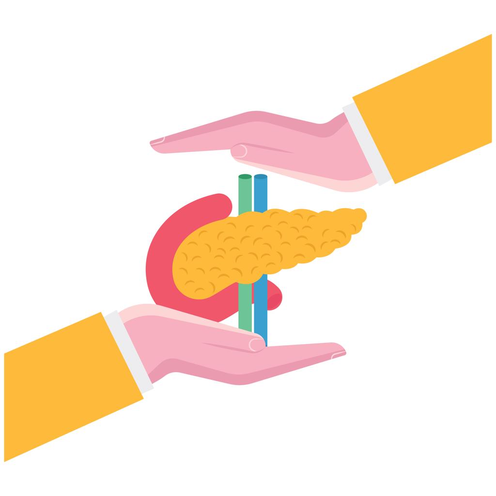 Pancreas Cancer: Symptoms, Stages, Diagnosis, and Treatment Options